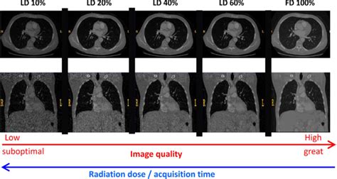 Automated Pulmonary Nodule Classification From Low Dose Ct Images Using
