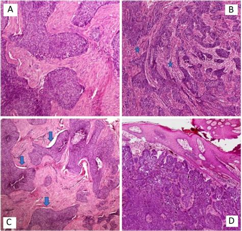 Pathological Findings A He X 400 Tumor Cell Showing Enlarged Download Scientific Diagram
