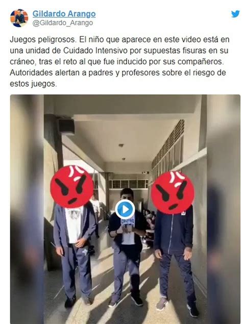 Rompe Cráneos El Nuevo Reto Viral Entre Adolescentes Que Es Mortal