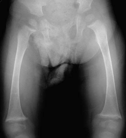 X Ray During Sex Cumception X Ray During Sex Cumception