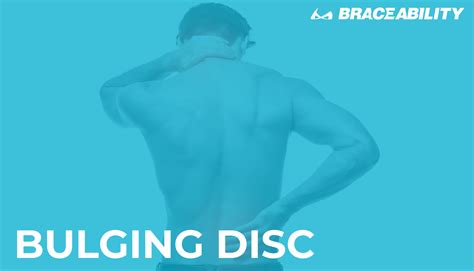 Do I Have A Bulging Disc Back And Cervical Bulged Disc Symptoms