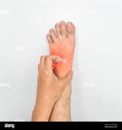 Asian Young Man Scratching His Foot Concept Of Itchy Skin Diseases