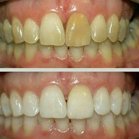 Ap 24 Toothpaste Flouride Formula Whitening 110 Oz Artofit