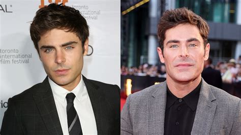 Zac Efron Then And Now Photos Before And After Jaw Surgery Betches