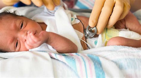 Apnea Of Prematurity Definition Causes Symptoms Diagnosis Treatment