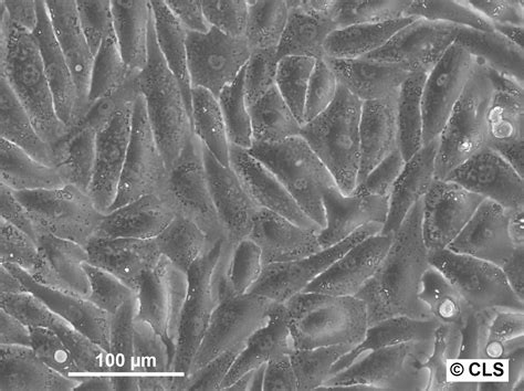 Cellules Rcc Of1