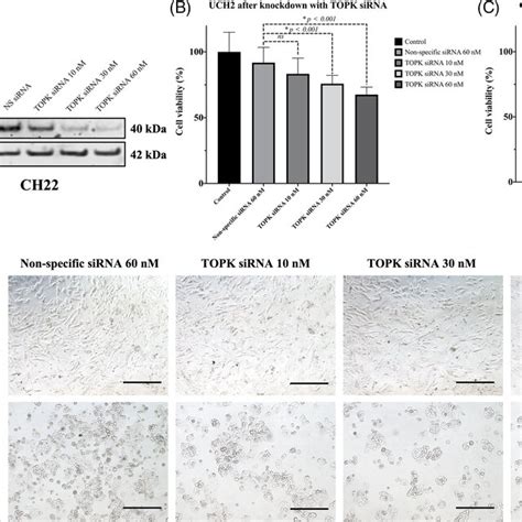 Topk Expression Density By Immunohistochemical Staining Of A Chordoma
