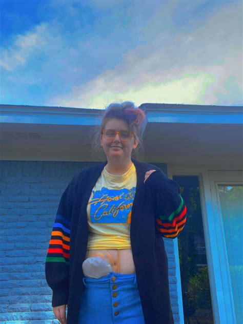 Working On Self Love With My Permanent Ostomy Today I Left The House