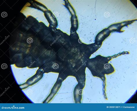 The Head Louse Pediculus Humanus Capitis Stock Image Image Of