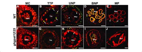 Tunel Assay For The Detection Of Dna Fragmentation In Anthers Of Hm 1 Download Scientific