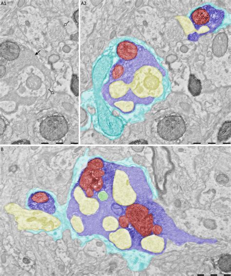 5 Pir Md Synapse Cross Sections A1 Electron Microscopic Download Scientific Diagram
