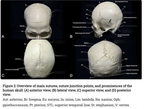 Practicum Axial Skeleton A Sutures Diagram Quizlet