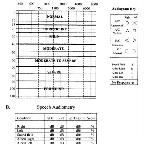Audiologic Testing Procedures Download Table