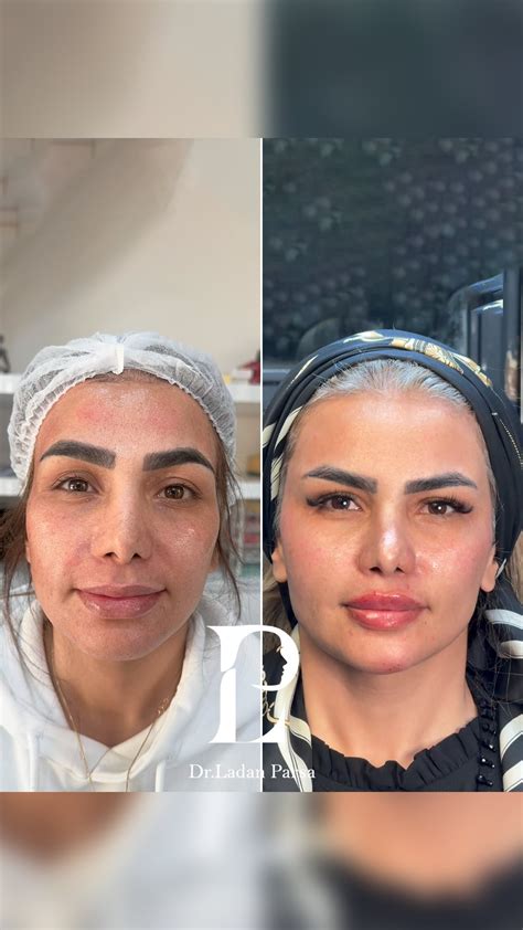 ‎دکتر لادن پارساشیراز‎ Drladanparsa • Instagram Photos And Videos