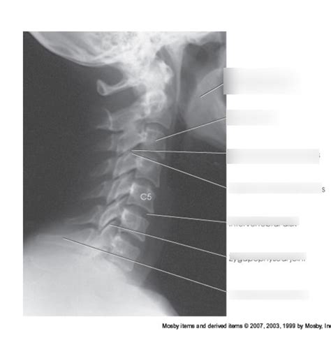Lateral C Spine Diagram Quizlet