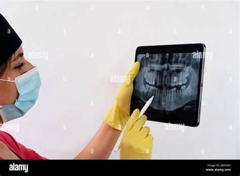 He X Ray Is Of An Old Young Male Female And Explains The Procedure He X Ray Is Of An Old Young Male Female And Explains The Procedure