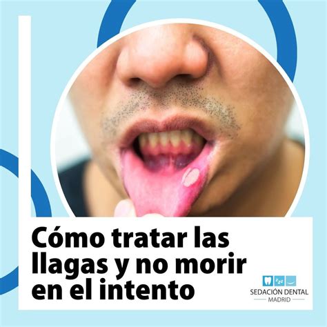 Sintético 9 Foto Imágenes De Llagas En La Piel Actualizar