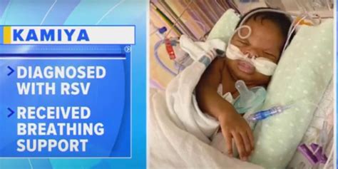 What Does A Babies Breathing Look Like With Rsv At Jaclyn Glenn Blog