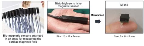 Measurement Of Weak Magnetic Fields From Minute Areas Possible Migne