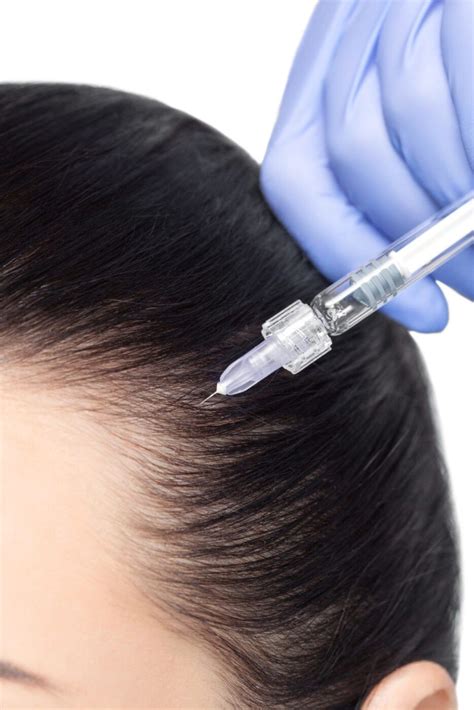 INTRADERMOTERAPIA CAPILAR Host Clínica