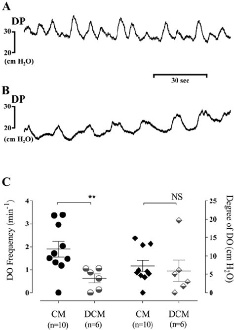 Parameters Associated With Detrusor Overactivity Do A And B Download Scientific Diagram