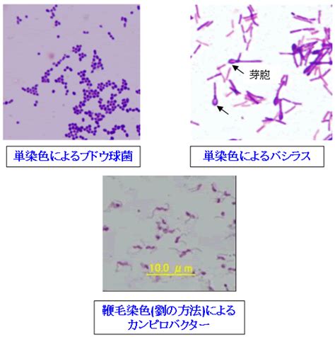 染色法細菌の検査 各論神奈川県衛生研究所