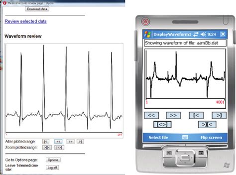 Example Of Waveform Display On Browser Left And Pda Application Right Download Scientific
