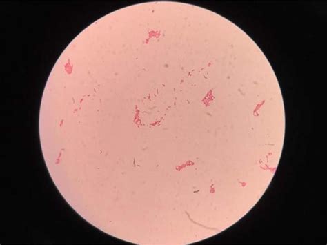 Gram Stain Small Bipolar Gram Negative Bacilli Download Scientific