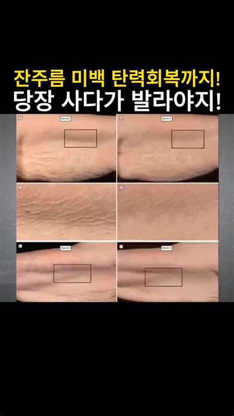 척추 관리 기립근 관리 체형교정 운동하는여자 관리하는여자 운동하는남자 운동하는직장인 운동하는엄마
