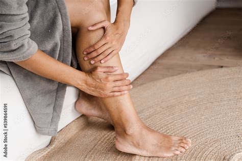 Deep Vein Thrombosis And Varicose Of African Woman Girl Touching Her