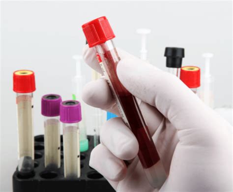 Understanding ERCP A Detailed Guide For Patients