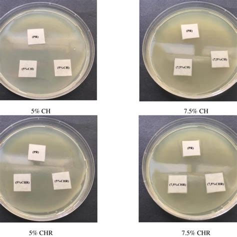 Antibacterial Activity Of All Samples Against Escherichia Coli K12