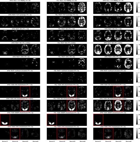 Spatial Distribution Of Significant Clusters In Afni Left Fsl Download Scientific Diagram