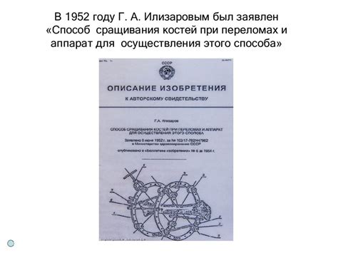 Аппарат Илизарова — презентация