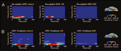 Phase Locking Analysis Implying That Cortical Interactions Between The