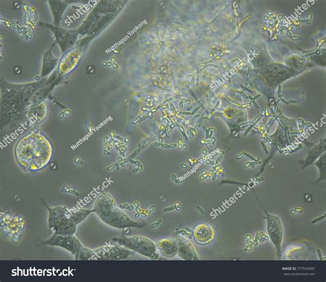 Bacterial Contamination Cell Culture