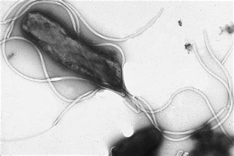 Proteobacteria Microbiology