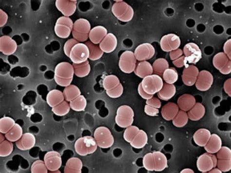 Pediococcus Friend And Foe The Brewers Journal