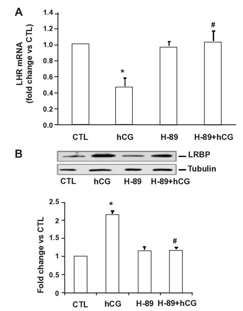 Effect Of Pka Inhibitor H 89 On The Expression Of Lhr Mrna And Lrbp