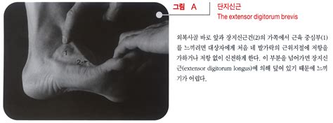 발족부의 근육 02 Extensor Hallucis Brevis 짧은엄지폄근 단무지신근短拇趾伸筋 네이버 블로그