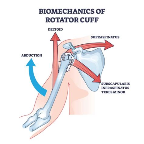 Supraspinatus Tendon Tear Treatment