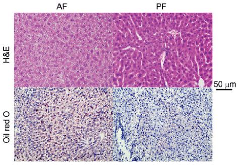 Effect Of Alcohol On Liver Histopathological Alterations Liver