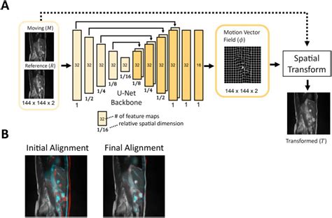 Fast Deformable Image Registration For Real Time Target Tracking During Radiation Therapy Using