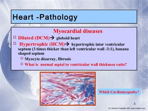 7 Heart Pathology Myocadial Diseases
