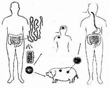 猪肉绦虫图册 360百科