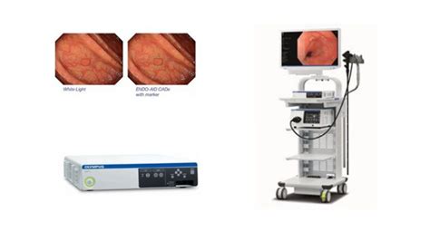 Olympus Launches Endo Aid An Ai Powered Platform For Its Endoscopy System G Medtech News Center