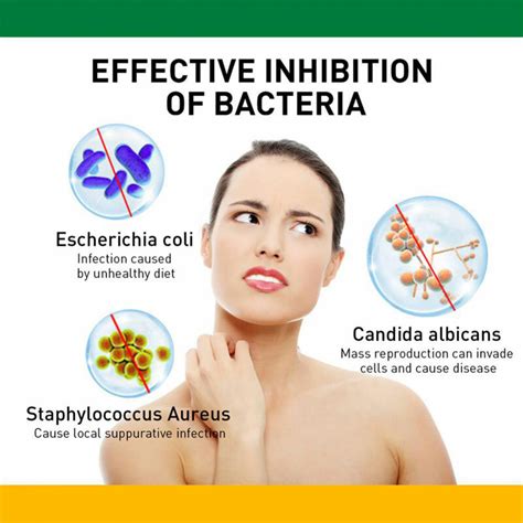 Atopic Dermatitis Cream Psoriasis Ointment Chinese Herb Anti Fungal