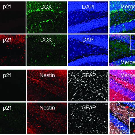 There Is Upregulation Of P53 And P21 In Dentate Gyrus After