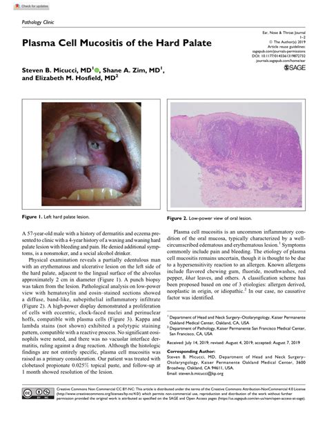 Pdf Plasma Cell Mucositis Of The Hard Palate