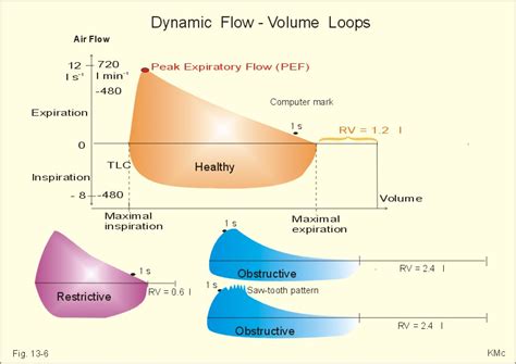 Lung Flow Dynamics At Dorothy Ledford Blog